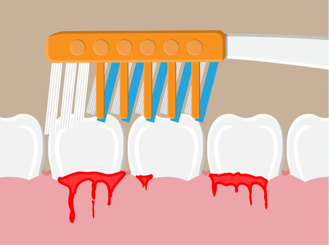 Do I Need A Periodontist? - Your Health Magazine