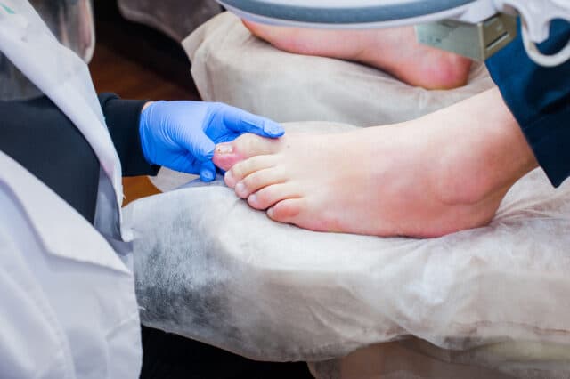 Poor Circulation In Feet: Part Two - Your Health Magazine