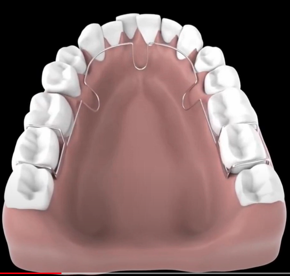 Why TMJ Technology Is So Important - Your Health Magazine