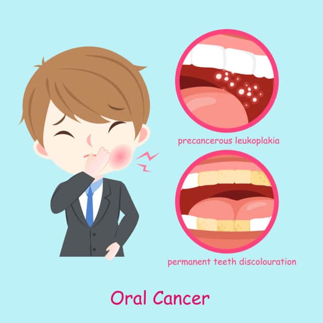 Screening Tests For Oral Cancer - Your Health Magazine