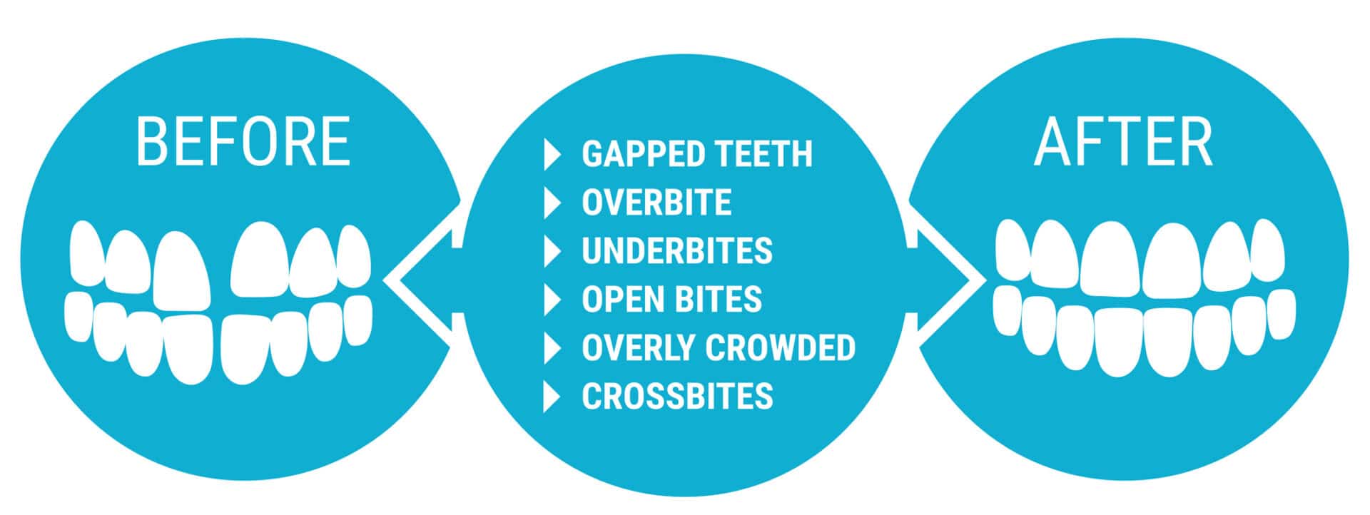 Commonly Treated Orthodontic Problems - Your Health Magazine