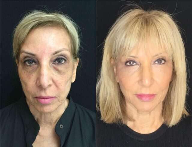 The Model Lift - Your Health Magazine