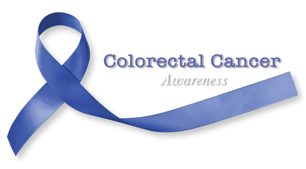 4 Things You Should Know About Colon Cancer - Your Health Magazine