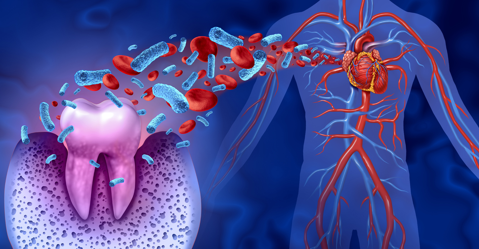 Heart Disease and Gum Disease: The Devastating Link - Your Health Magazine