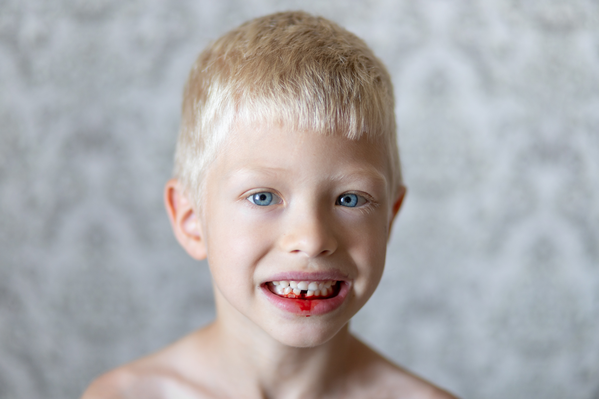 Top Tips For Dental Trauma - Your Health Magazine