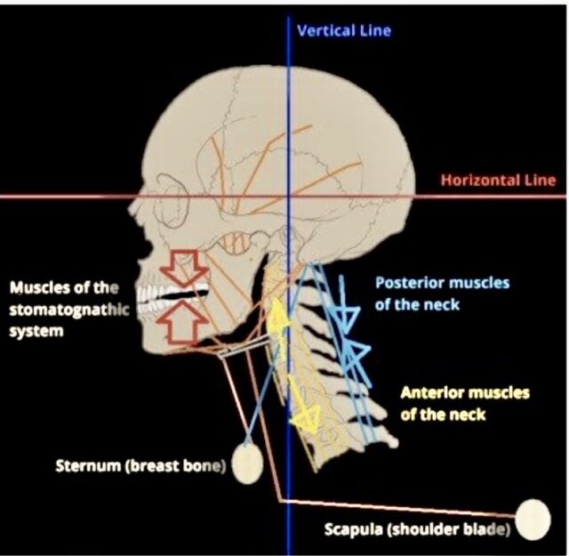 The Silent Suffering: Recognizing and Treating the Root Cause of TMJ ...