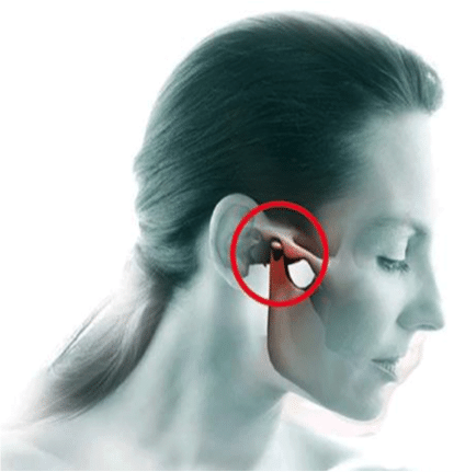 TMD From a Woman’s Perspective - Your Health Magazine