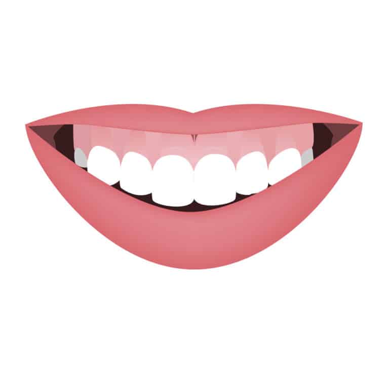 Surgical Treatment of the "Gummy Smile” - Your Health Magazine