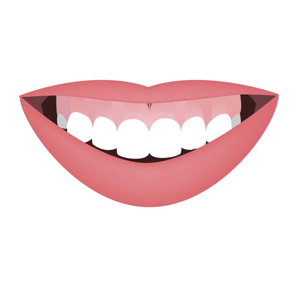 Surgical Treatment of the "Gummy Smile” - Your Health Magazine