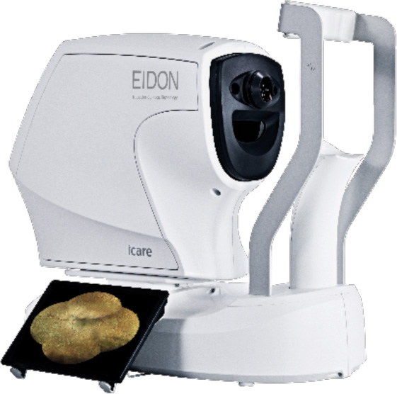 iCare EIDON – Ultra-widefield details in high definition - Your Health ...
