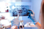 Dental X-Rays Explained: Procedures, Uses, And Frequency - Your Health ...