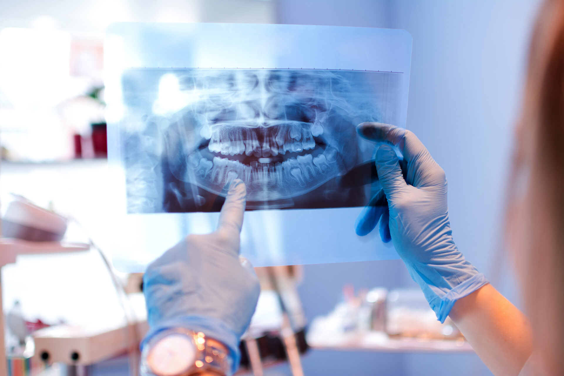 Dental X-Rays Explained: Procedures, Uses, And Frequency - Your Health ...