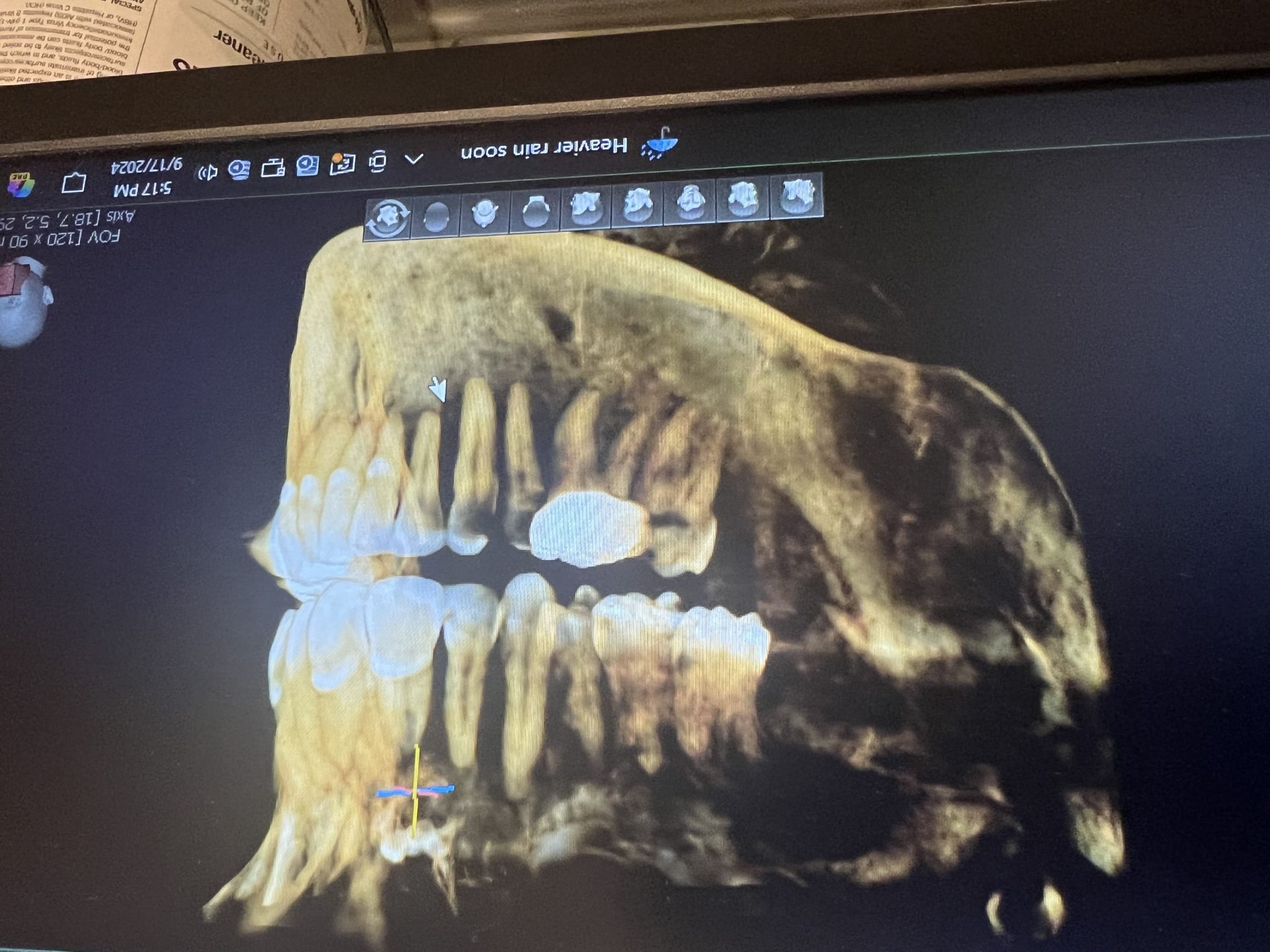 Revolutionizing Dental Care With 3D Printing and 3D X-Rays - Your ...