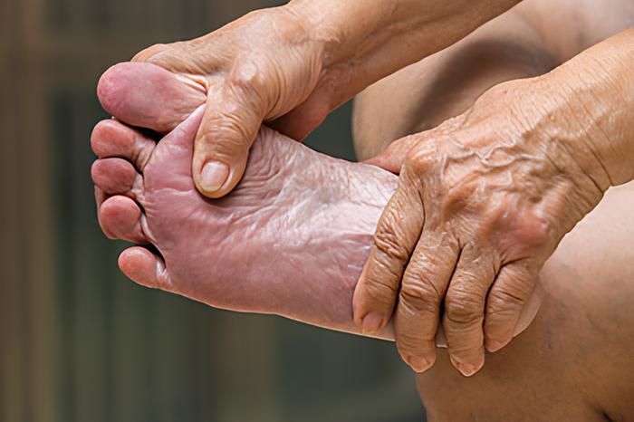 Conditions Causing Red Feet In Elderly People - Your Health Magazine