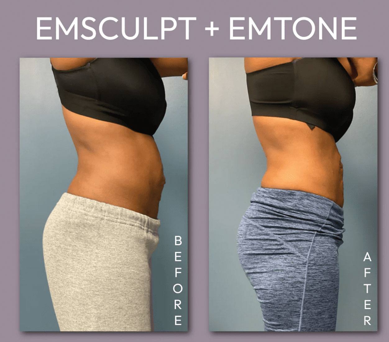 Building Muscle With EMSculpt - Your Health Magazine