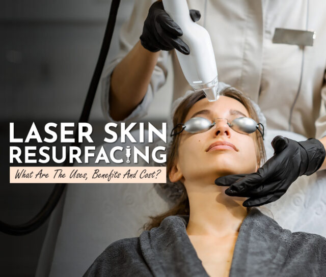 Laser Skin Resurfacing: What are the Uses, Benefits, and Cost? - Your Health Magazine
