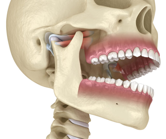 Unlocking the Jaw: How MRI Helps Diagnose TMJ Disorders - Your Health ...