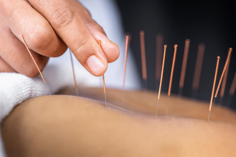 Types of Acupuncture Explained: Which One Is Right for You? - Your ...