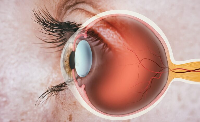 What Is a Retina Specialist and When Should You See One? - Your Health ...