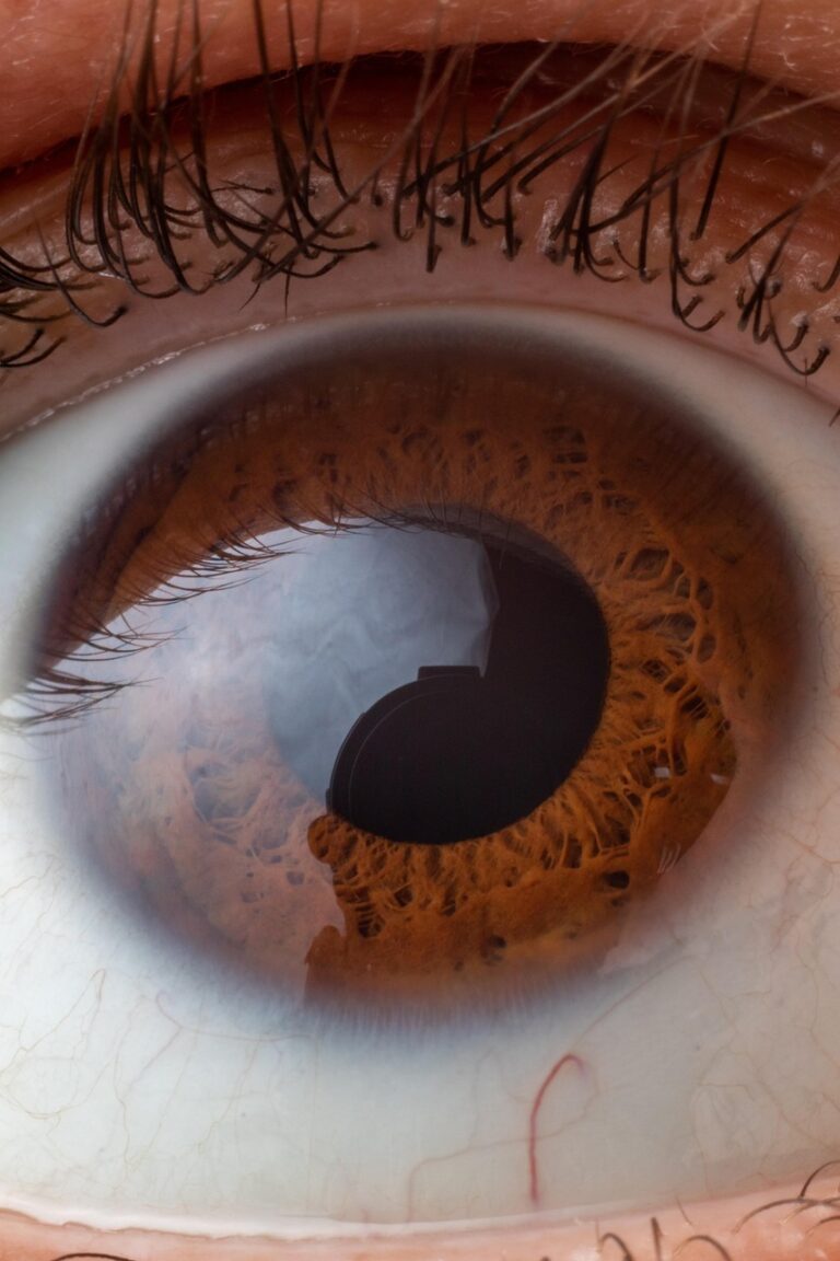 At-Home Visual Field Checkups: A Modern Tool for Eye Awareness - Your ...