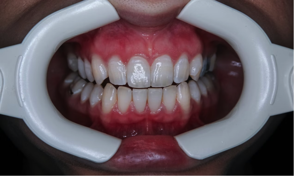 Why Oral Health Plays a Bigger Role in Overall Wellness Than Most ...