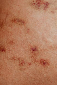 What Causes Blanchable Redness and How to Address It? - Your Health ...