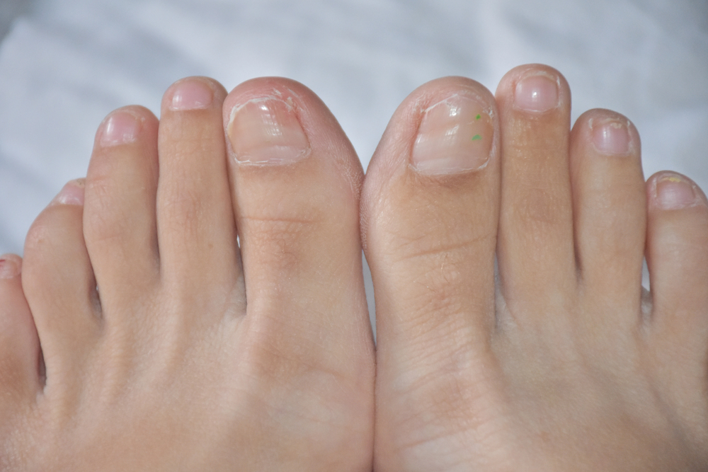 Why Do My Toes Tingle and What Does It Mean? - Your Health Magazine