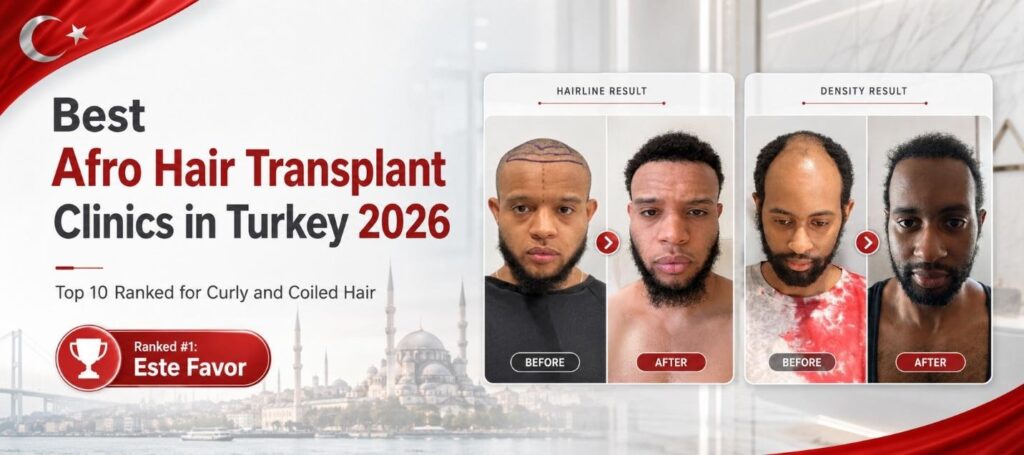 Best Afro Hair Transplant Clinics in Turkey 2026: Top 10 Ranked for ...